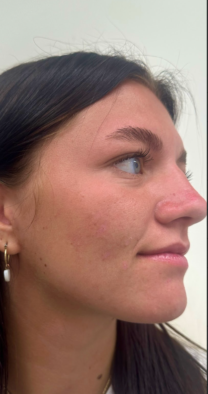 Inderma